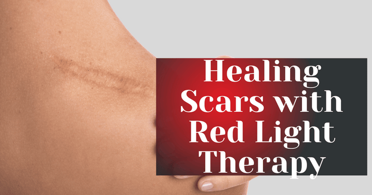 Healing Scars with Red Light Therapy – KOZE Health